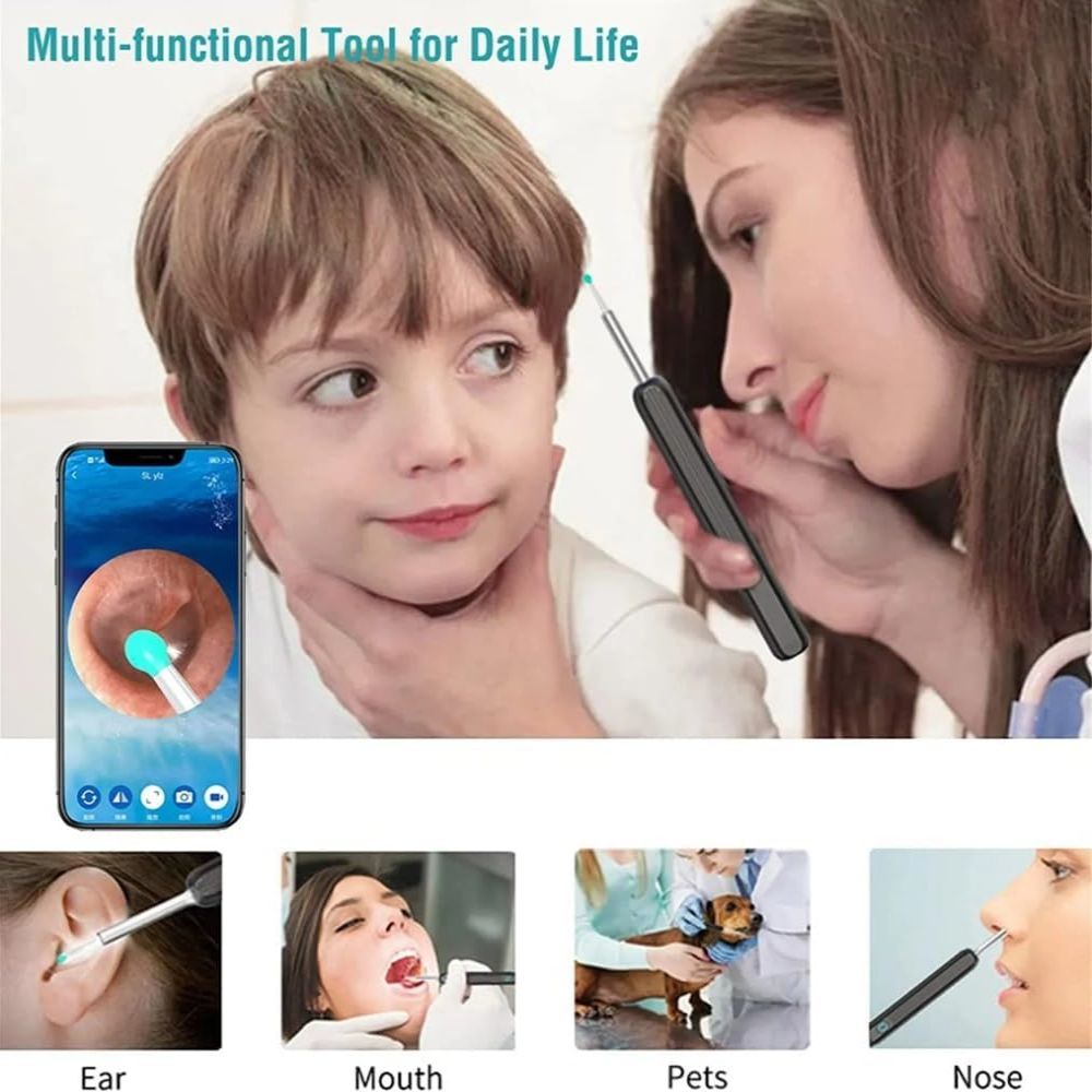 Smart Visual Ear Cleaner - GLADWARES